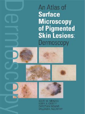 An Atlas of Surface Microscopy of Pigmented Skin Lesions: Dermoscopy ...